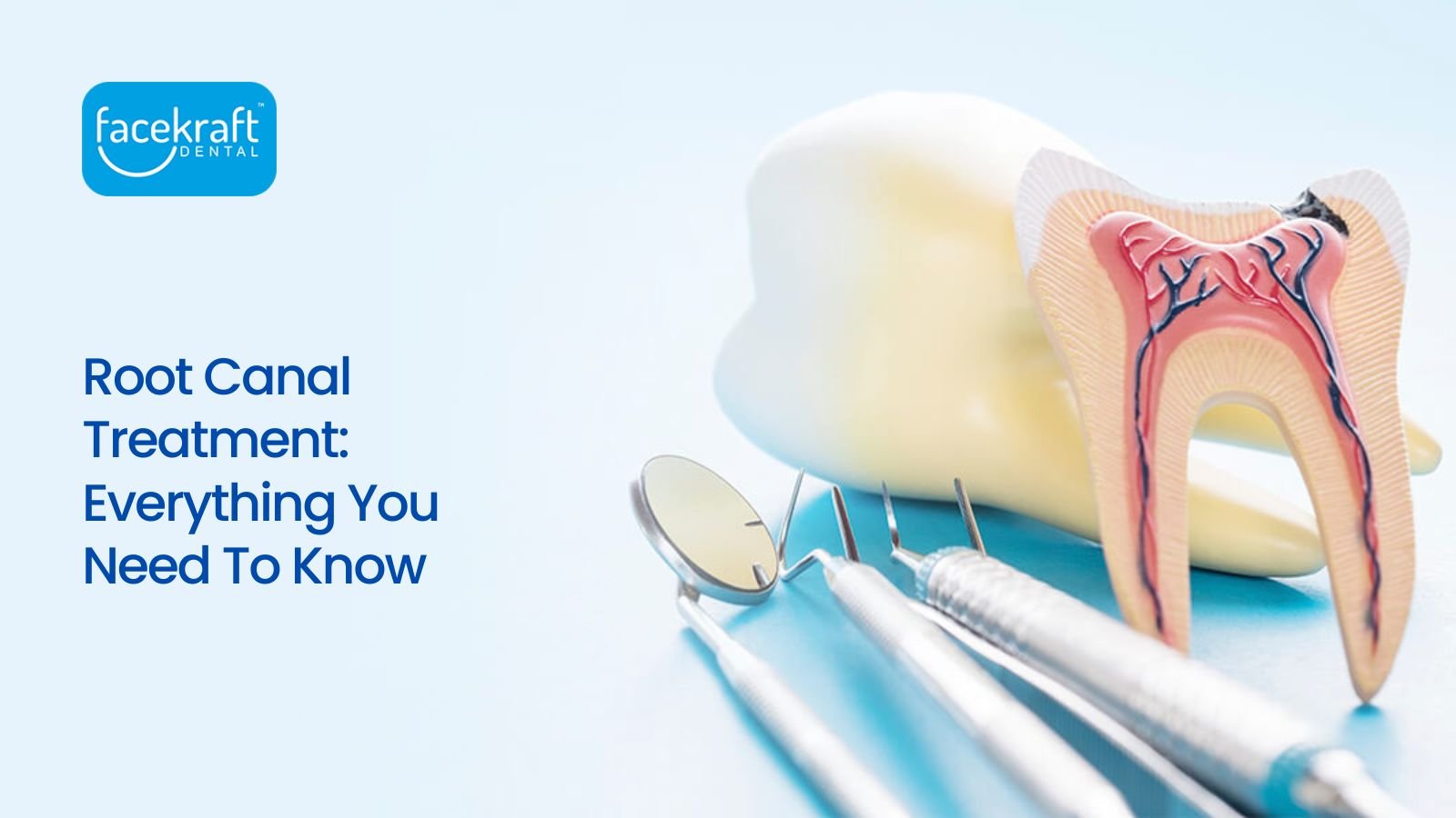 Everything You Need To Know about Root Canal Treatment. - Face Kraft Clinic